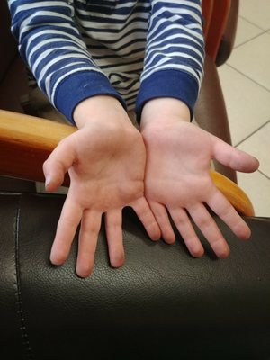 RICHARD BUTLIG, MD - Updated December 2025 - 31 Reviews - 1000 E ...