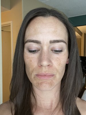 GLO MED SPA AUSTIN - Updated October 2025 - 101 Photos & 47 Reviews - 9801 Anderson Mill Rd ...