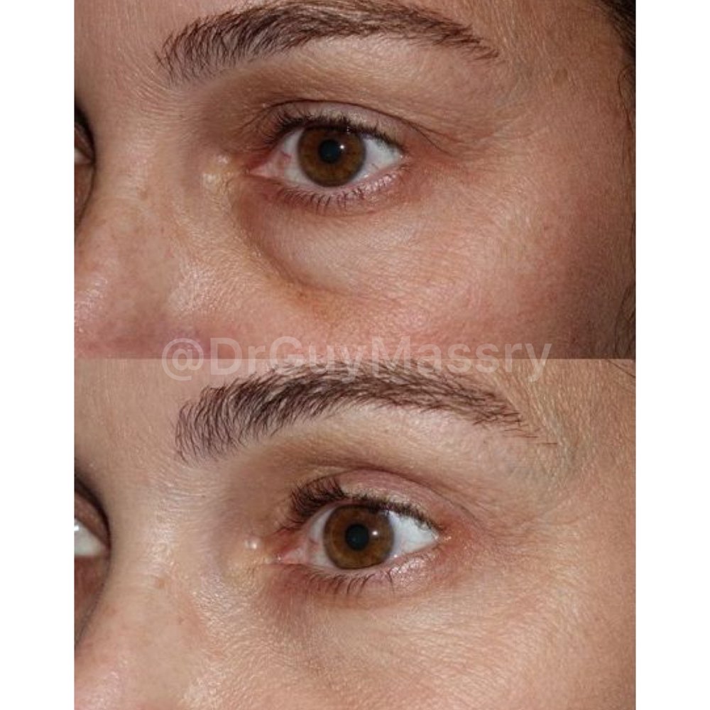 GUY MASSRY, MD - Updated June 2024 - 148 Photos & 136 Reviews - 150 N ...