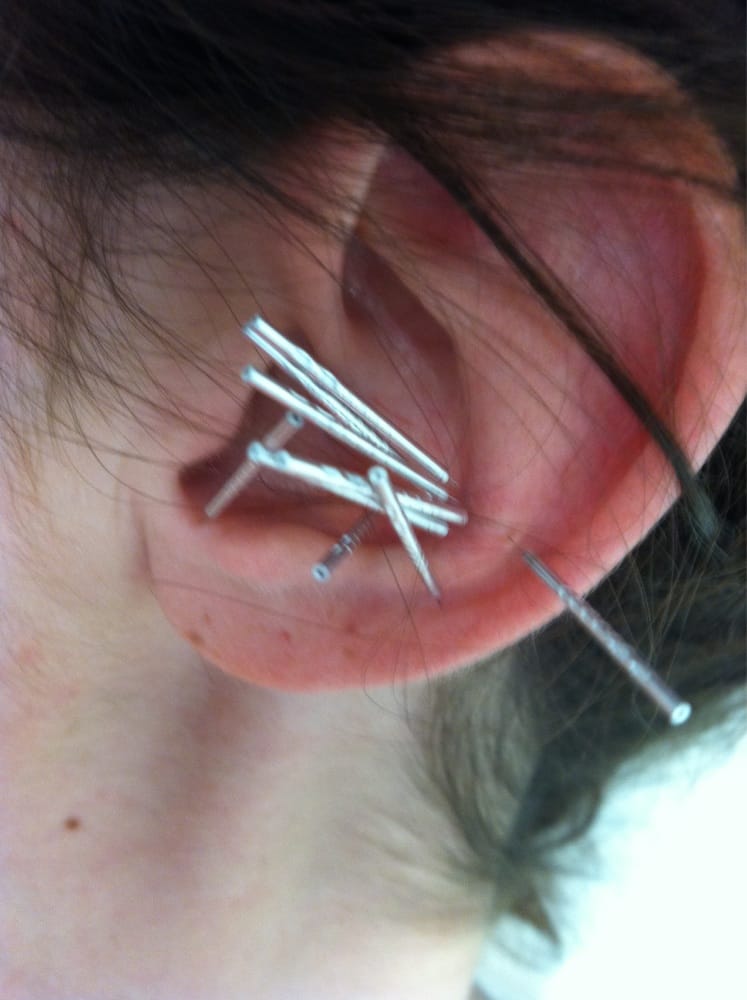 LIBERTYVILLE ACUPUNCTURE - Updated September 2025 - 11 Reviews - 737 N ...