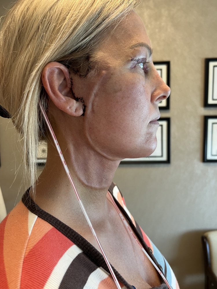 THE SEATTLE FACIAL PLASTIC SURGERY CENTER - Updated July 2025 - 52 ...