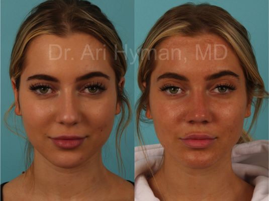 ARI HYMAN, MD - Updated October 2024 - 388 Photos & 57 Reviews - 16311 ...