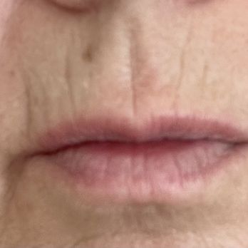 PROLASE LASER CLINIC - 113 Photos & 632 Reviews - 15030 Ventura Blvd ...