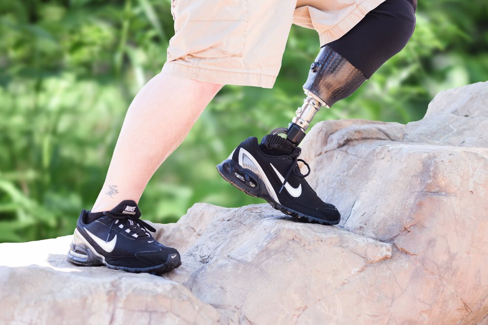 INNOVATIVE PROSTHETICS - Updated December 2025 - 935 S Kimball Ave ...