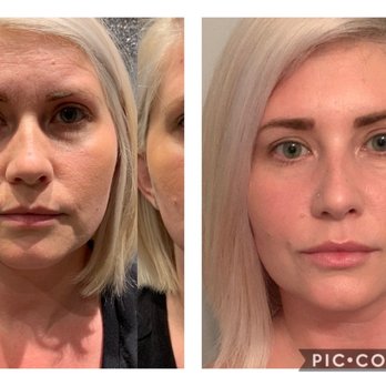 ATLANTA MEDICAL AESTHETICS - Updated November 2025 - 56 Reviews & 65 ...