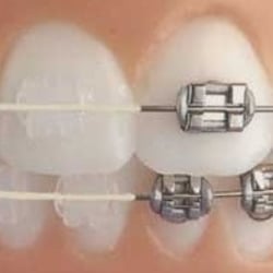 SOMOS DENTAL & ORTHODONTICS - MESA - 33 Photos & 17 Reviews - 1245 E ...