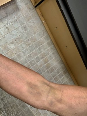 LABCORP - Updated July 2025 - 12 Photos & 10 Reviews - 107 Southern ...