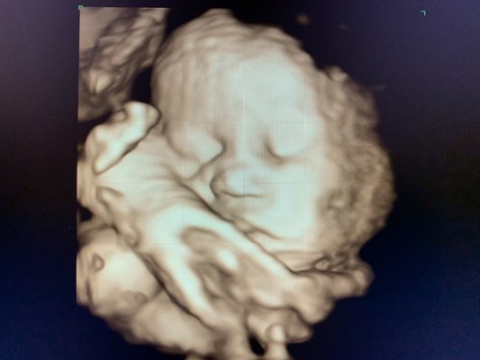 THOMAS TRI QUACH, M.D. OBGYN - Updated December 2025 - 27 Photos & 74 ...