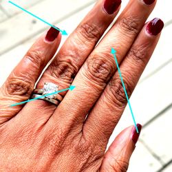 GEORGIA SKIN SPECIALISTS - 17 Photos & 55 Reviews - 1800 Howell Mill Rd ...