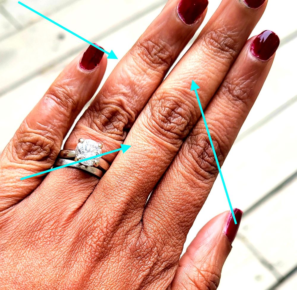 GEORGIA SKIN SPECIALISTS - Updated October 2025 - 18 Photos & 64 ...