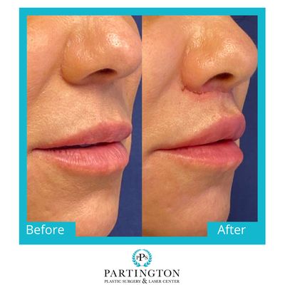 PARTINGTON PLASTIC SURGERY AND LASER CENTER - Updated February 2025 ...