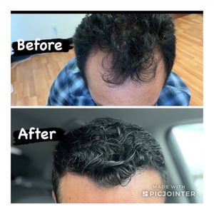 ADVANCED HAIR RESTORATION - 32 Photos & 16 Reviews - 9301 Wilshire Blvd ...