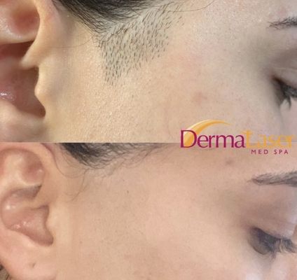 DERMALASER MED SPA - Updated October 2025 - 67 Photos & 29 Reviews ...