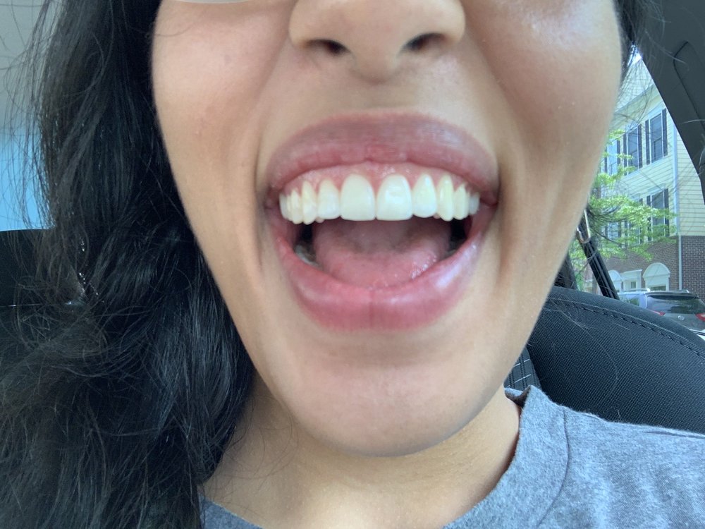 STILES DENTISTRY - Updated August 2024 - 20 Photos & 10 Reviews - 333 ...