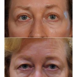 JEFFREY JOSEPH, MD - 36 Photos & 63 Reviews - Cosmetic Surgeons - 5010 ...