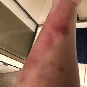 LITTLE ROCK THAI MASSAGE - Massage Therapy - 315 N Bowman Rd, Little ...