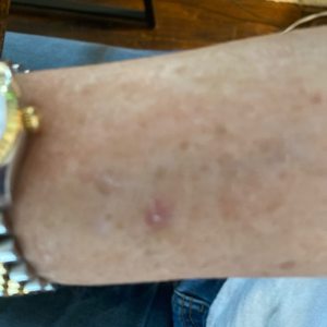 BEXAR IMAGING - Updated October 2025 - 25 NE Loop 410, San Antonio ...