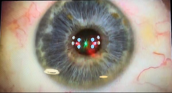 NVISION EYE CENTERS - TORRANCE - Updated December 2025 - 43 Photos ...