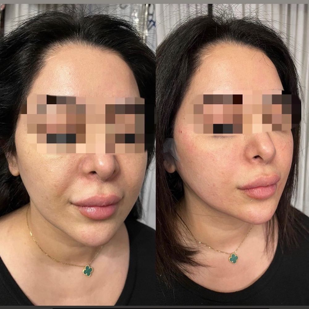 Rachel Ruppel's Instagram, Twitter & Facebook on IDCrawl