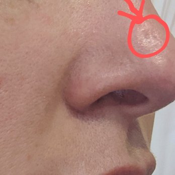 MEDDERM DERMATOLOGY - Updated May 2024 - 67 Photos & 158 Reviews - 3965 ...