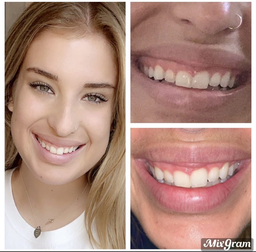 MINUTELLO JAMES S, DDS & MINUTELLO, DMD, MS - Updated January 2026 - 12 ...