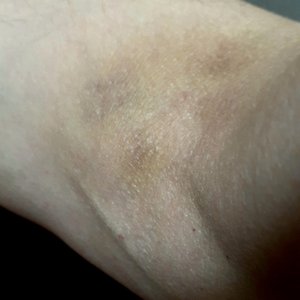 JOSHI MERCHANT, MD - Updated June 2025 - 43 Reviews - 5500 Knoll N Dr ...