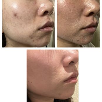 TROIAREUKE CALIFORNIA - Updated January 2025 - 52 Photos & 45 Reviews - 6752 Beach Blvd, Buena ...