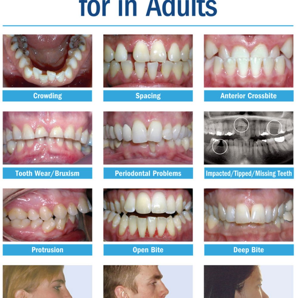 Adult orthodontics near me store