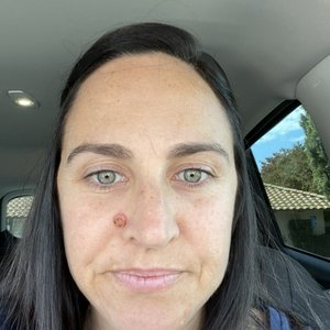 NATEE POOPAT, M.D. - Updated August 2025 - 11 Photos & 56 Reviews ...