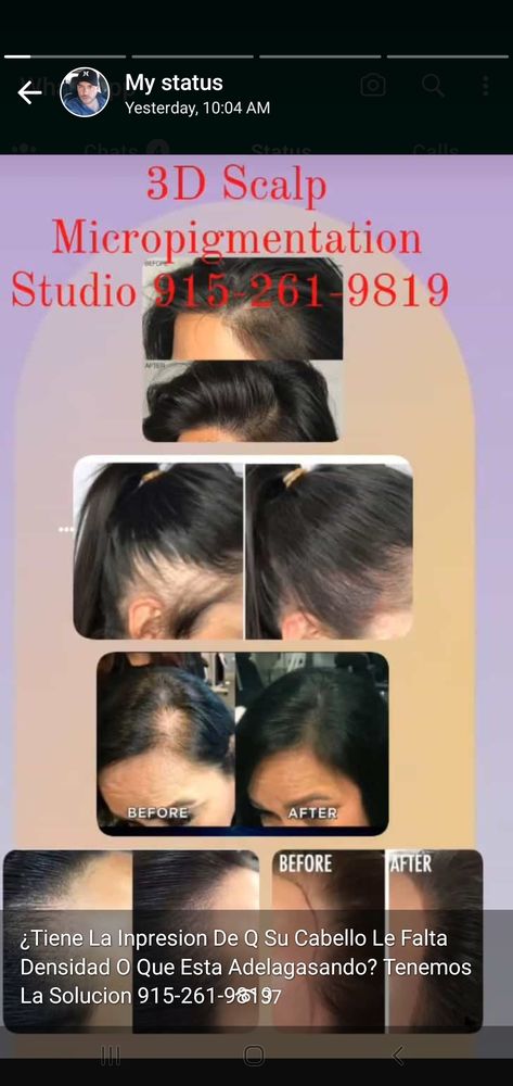 3D SCALP STUDIO - Request an Appointment - El Paso, Texas - Hair Loss Centers - Phone Number - Yelp