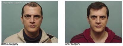 ROGER A ALLCROFT, MD FACS - Updated April 2026 - 14 Photos & 11 Reviews ...