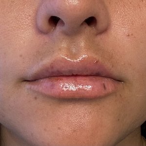 EFFACE AESTHETICS - 126 Photos & 98 Reviews - 1111 Montana Ave, Santa ...