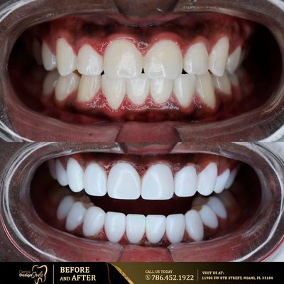 DENTAL DESIGN SMILE - Updated September 2025 - 47 Photos & 55 Reviews ...