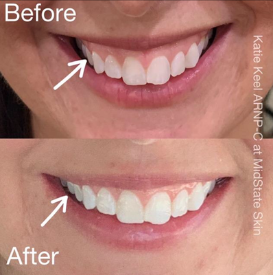 MIDSTATE SKIN INSTITUTE - Updated December 2025 - 34 Photos & 15 ...