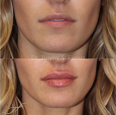 JIMMY S. FIROUZ, MD, FACS - 167 Photos & 367 Reviews - 416 N Bedford Dr ...