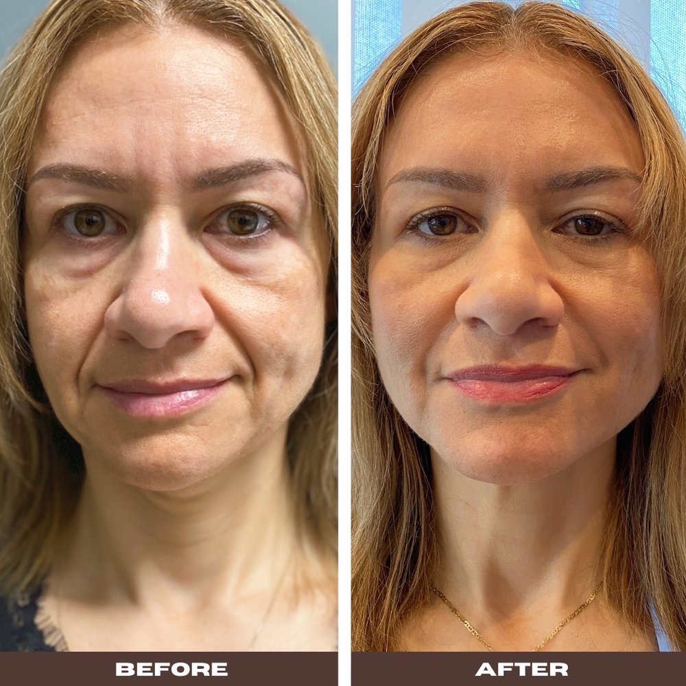 MODERNA LASER & MED SPA - Updated January 2025 - 113 Photos & 132 ...