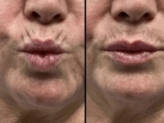 ANNE JUDGE AESTHETICS - Updated January 2026 - 46 Photos - 454 ...