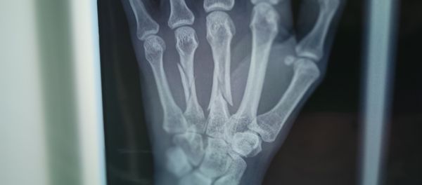 THE MINIMALLY INVASIVE HAND INSTITUTE - Updated July 2025 - 68 Photos ...