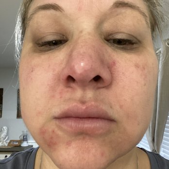 SUGENE KIM, MD FACS - SGK PLASTIC SURGERY - Updated September 2025 - 17 ...