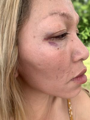 ESCAPE MED SPA - Updated December 2025 - 37 Photos & 24 Reviews - 353 S ...