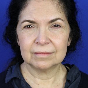 EVAN RANSOM, MD - 125 Photos & 182 Reviews - 450 Sutter St, San ...