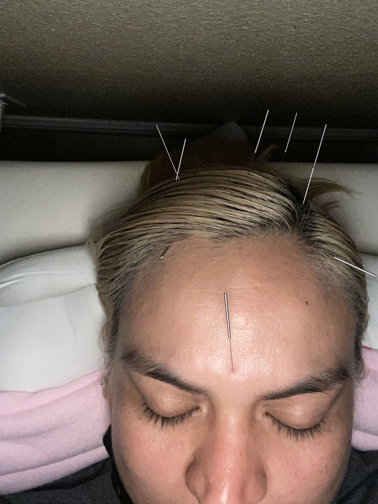 BENNETT ACUPUNCTURE AND FUNCTIONAL MEDICINE - Updated December 2025 ...