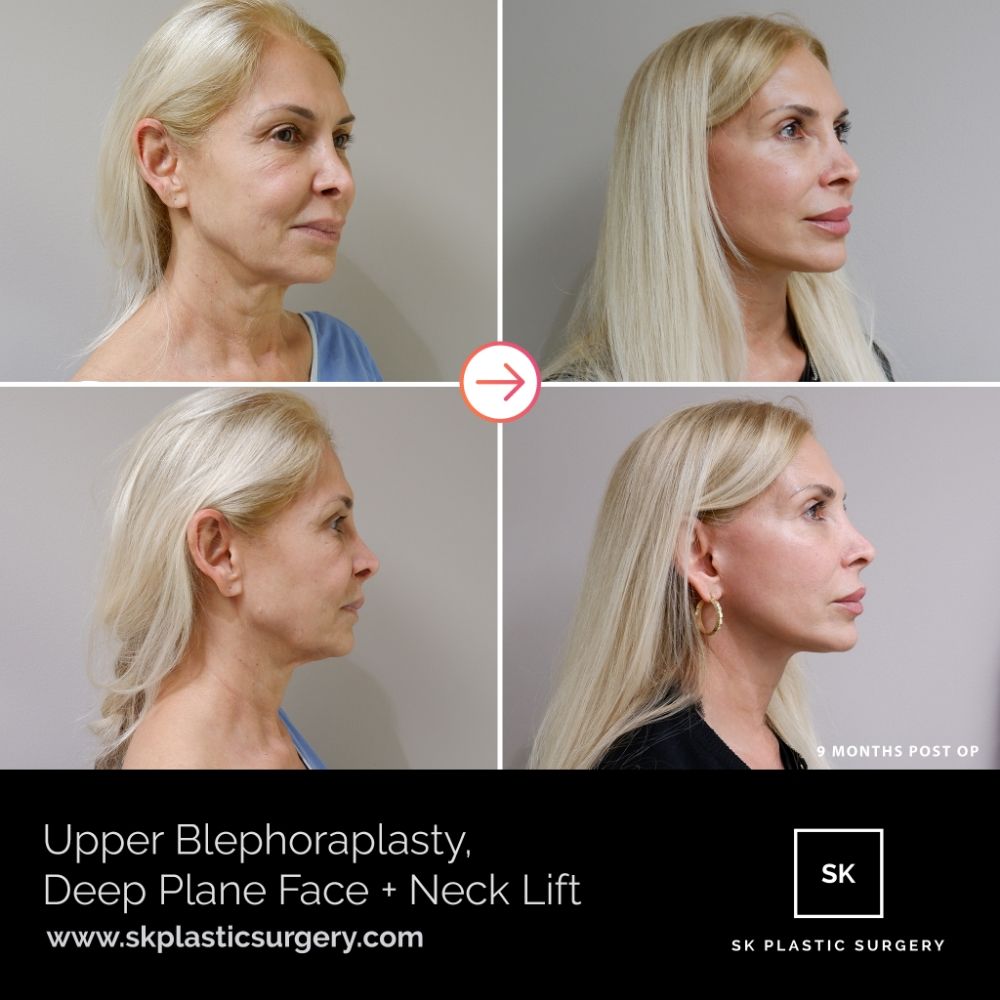 SK PLASTIC SURGERY - Updated May 2025 - 77 Photos & 159 Reviews - 239 S ...