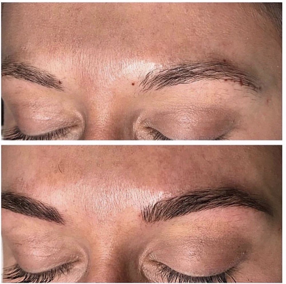 BLUE HALO MED SPA - Updated August 2024 - 33 Photos & 13 Reviews ...