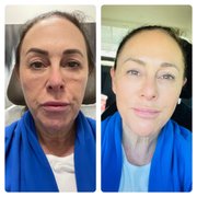 AZITA FAKHERI, MD - 50 Photos & 178 Reviews - Dermatologists - 19100 ...