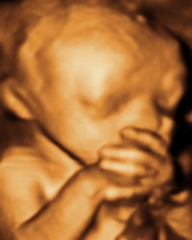 STORK VISION 3D/4D ULTRASOUND - Updated July 2025 - 2004 Highland Ave ...