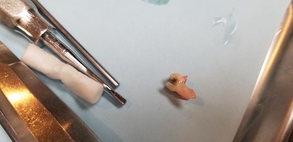 AMERICAN SMILE DENTAL CARE - 32 Photos & 75 Reviews - General Dentistry ...