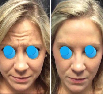 MIDSTATE SKIN INSTITUTE - Updated December 2025 - 34 Photos & 15 ...