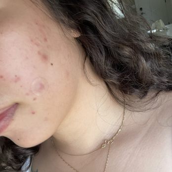 DERMASPACE - Updated December 2025 - 74 Photos & 178 Reviews - 509 ...