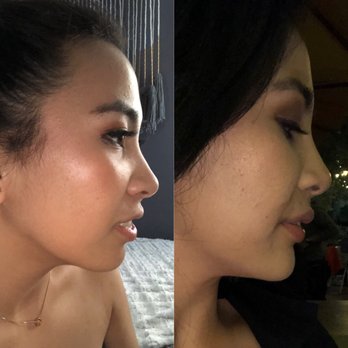 BEAU MEDSPA: AARON JENG, MD, MPH - Updated October 2025 - 60 Photos ...